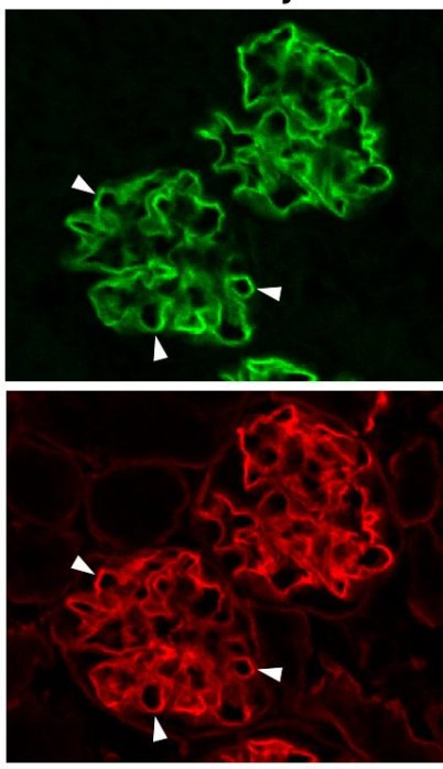 Laminin Research Highlights – Developments in Laminin Therapies – LaNts ...