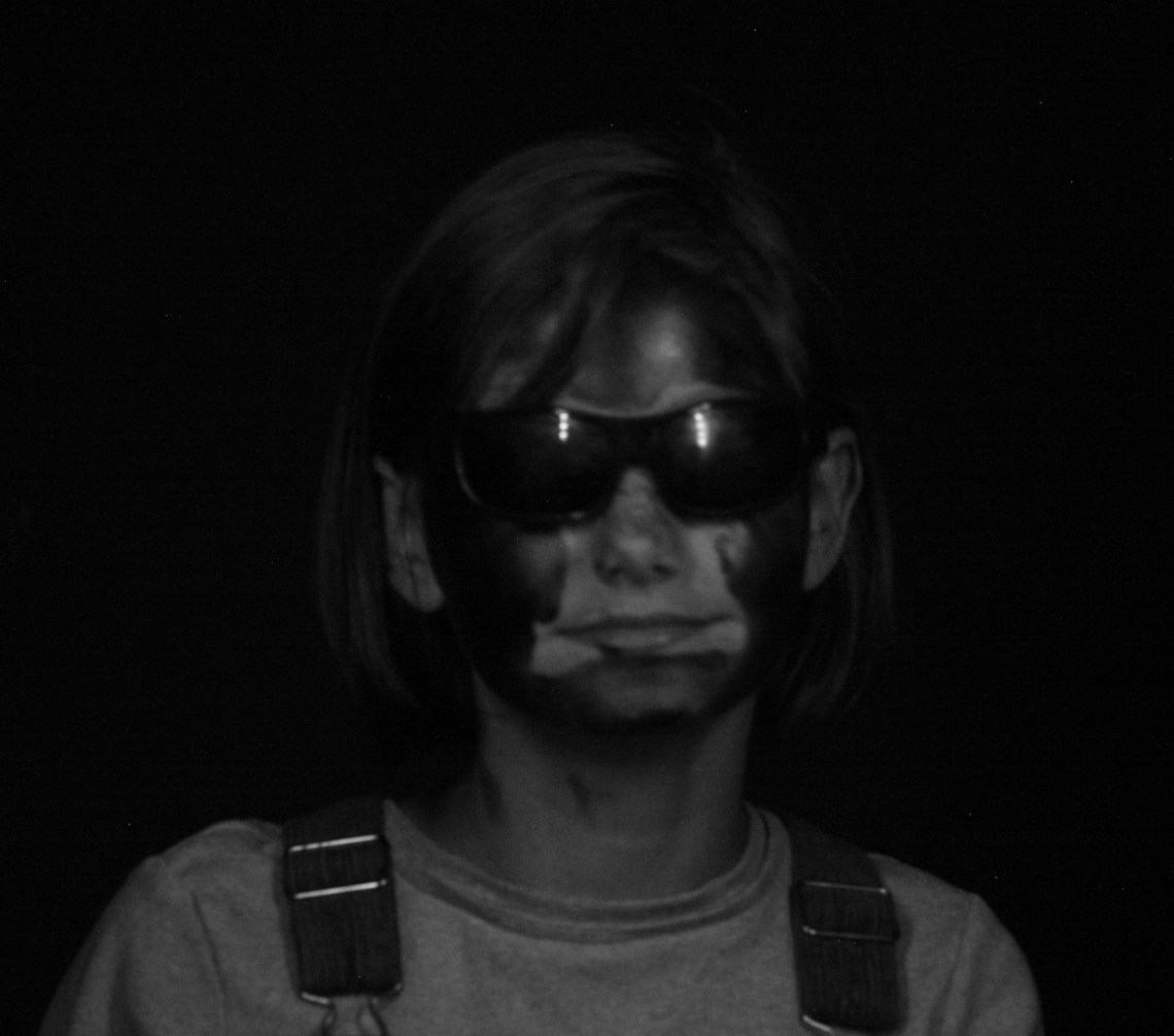 Superhero sunscreen? – LaNts and Laminins