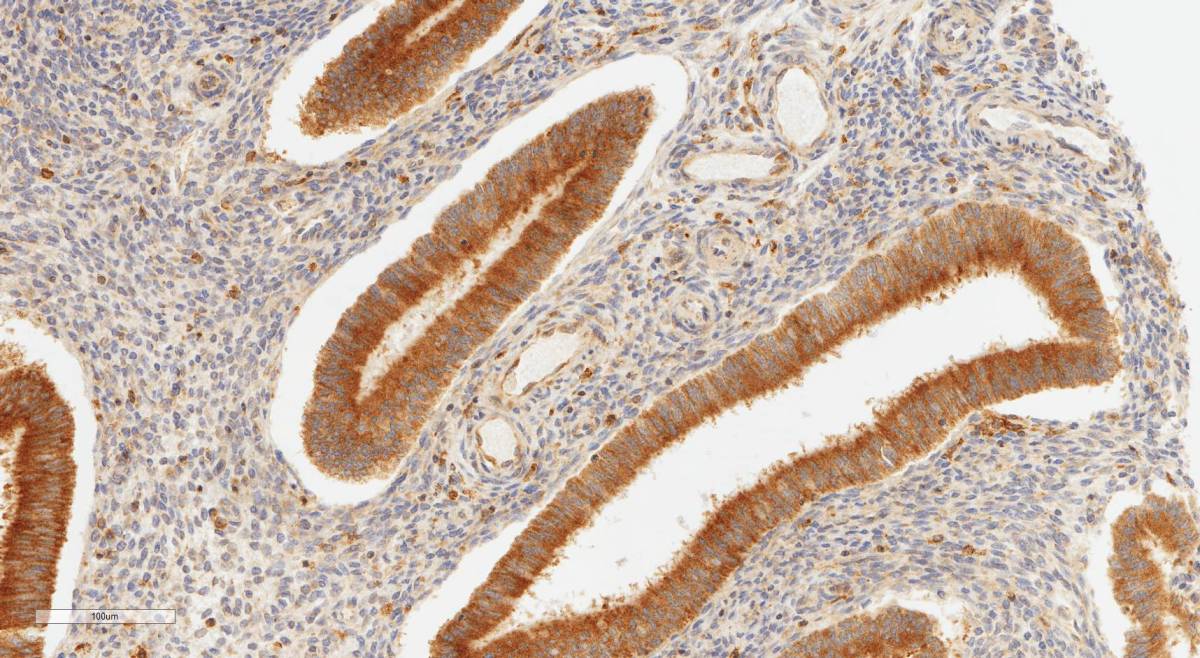 New paper published – Laminin N-terminus alpha31 (LaNt a31) protein ...